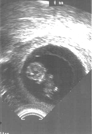 Ultraschalluntersuchungen